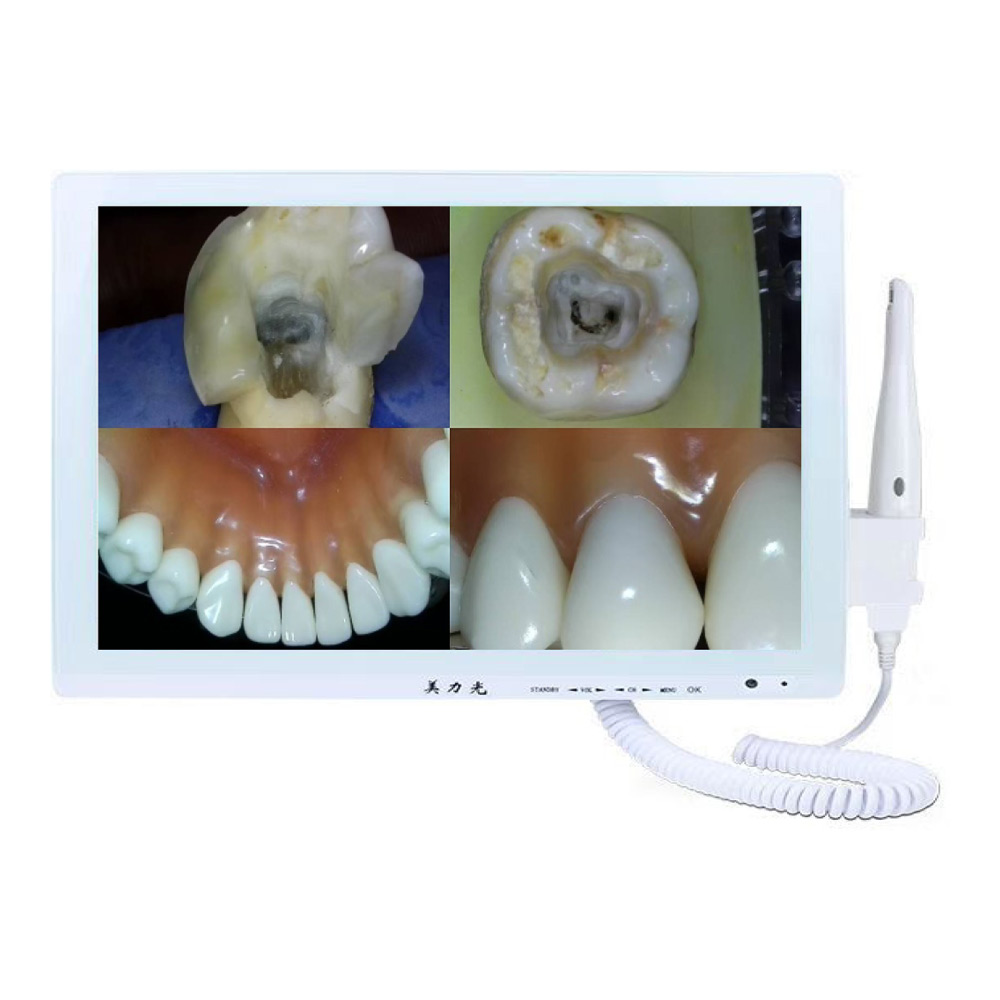 Intra Oral Camera-美力光